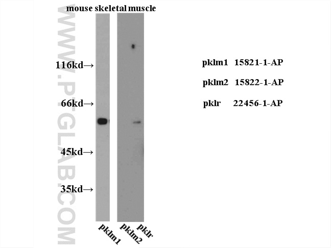 PKM2-specific antibody (15822-1-AP) | Proteintech | 武汉三鹰生物技术有限公司