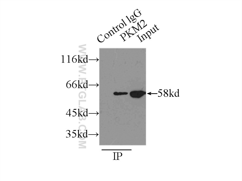 PKM2-specific antibody (15822-1-AP) | Proteintech | 武汉三鹰生物技术有限公司