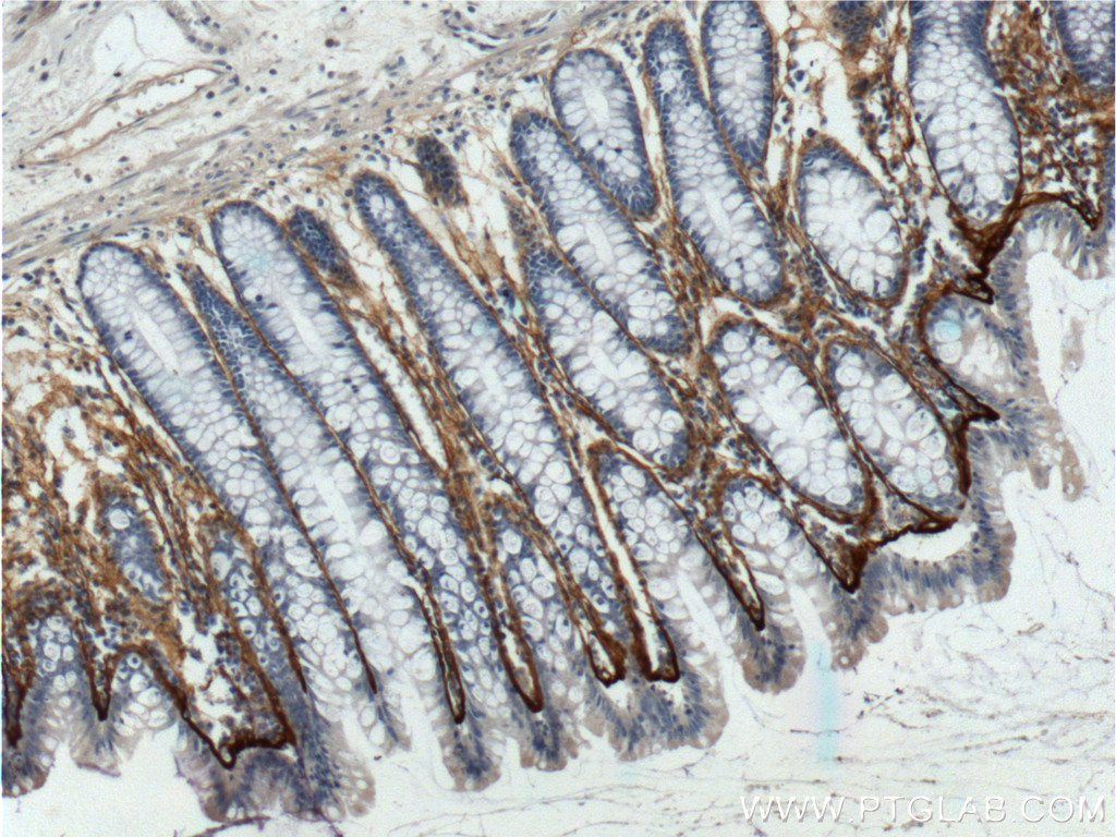 Periostin antibody (19899-1-AP) | Proteintech