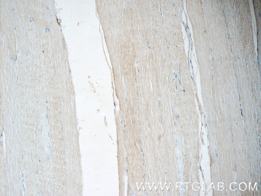 PPARA antibody (15540-1-AP) | Proteintech