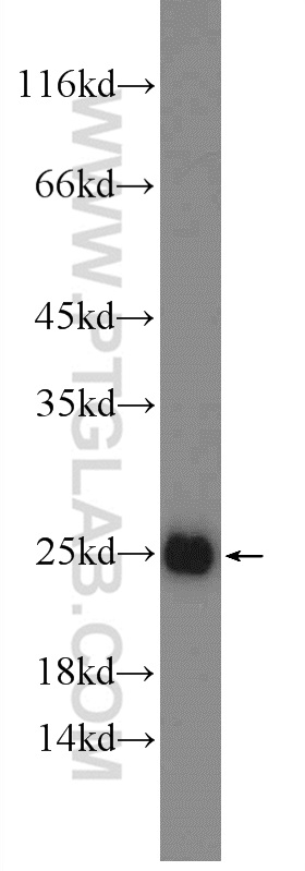 PPP1R15B antibody (14634-1-AP) | Proteintech | 武汉三鹰生物技术有限公司