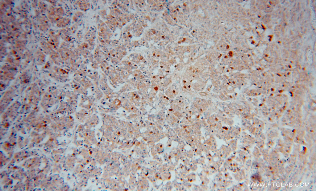 PRC1 Antibody 15617-1-AP | Proteintech