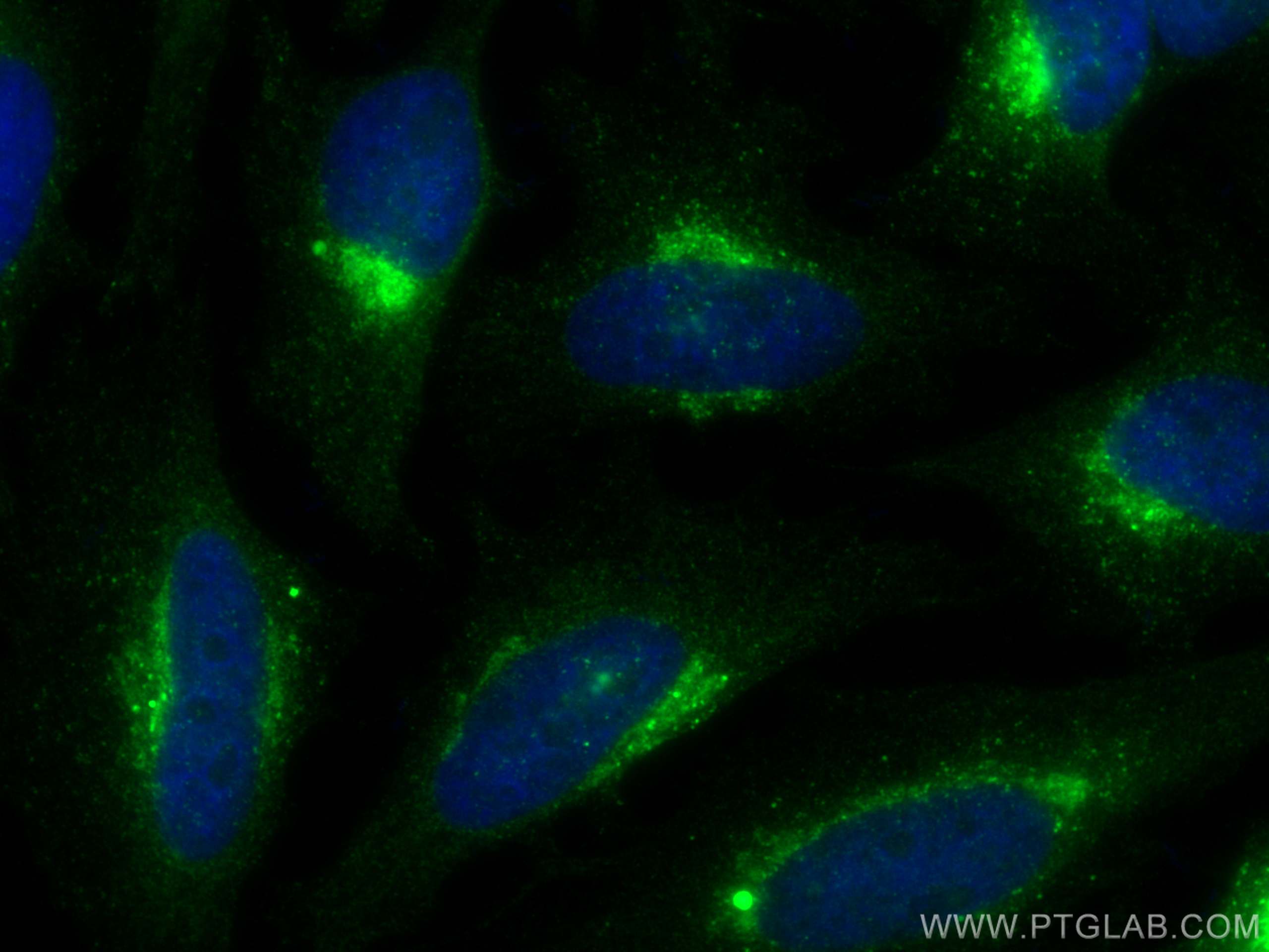 PSAP antibody (10801-1-AP) | Proteintech | 武汉三鹰生物技术有限公司