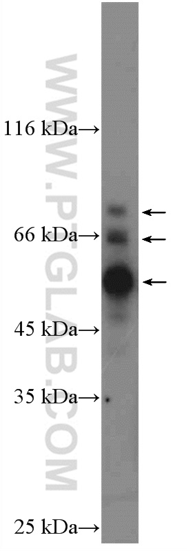 COX2/ Cyclooxygenase 2/ PTGS2 antibody (12375-1-AP) | Proteintech