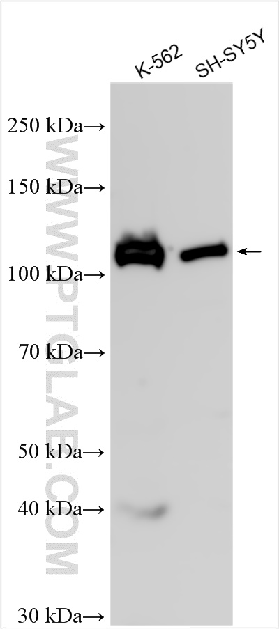 PTPN4 antibody (11131-1-AP) | Proteintech | 武汉三鹰生物技术有限公司