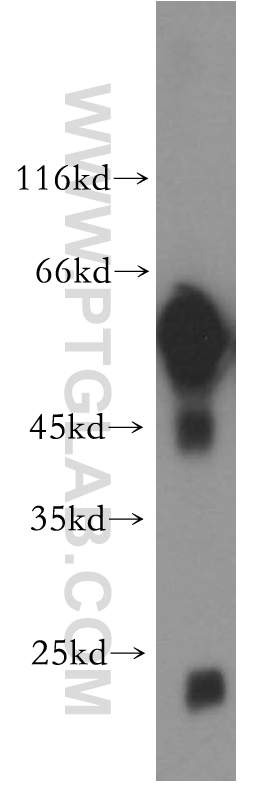 PTRF antibody (18892-1-AP) | Proteintech | 武汉三鹰生物技术有限公司