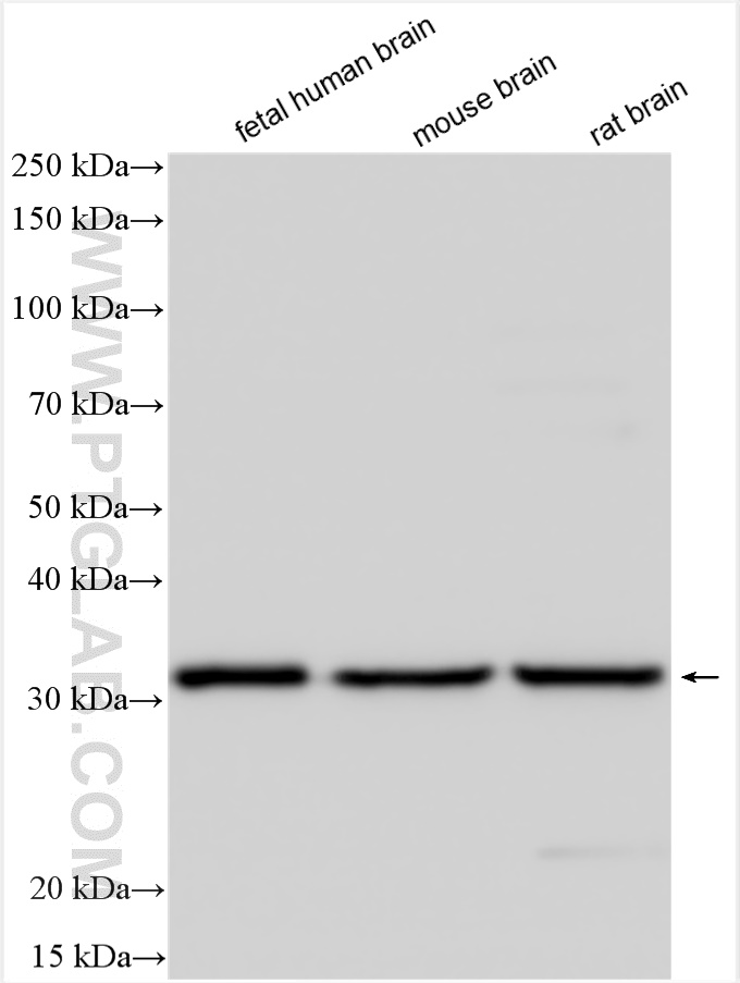RAB12 antibody (18843-1-AP) | Proteintech | 武汉三鹰生物技术有限公司