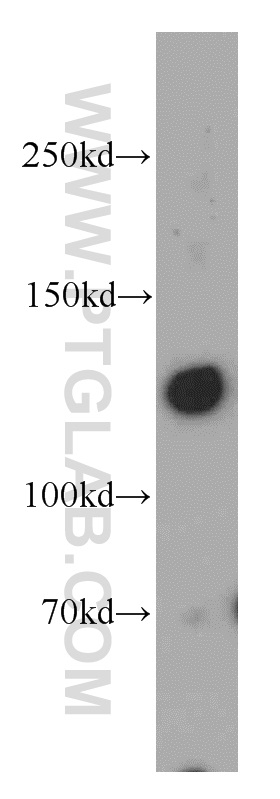 RAB3GAP1 antibody (21663-1-AP) | Proteintech