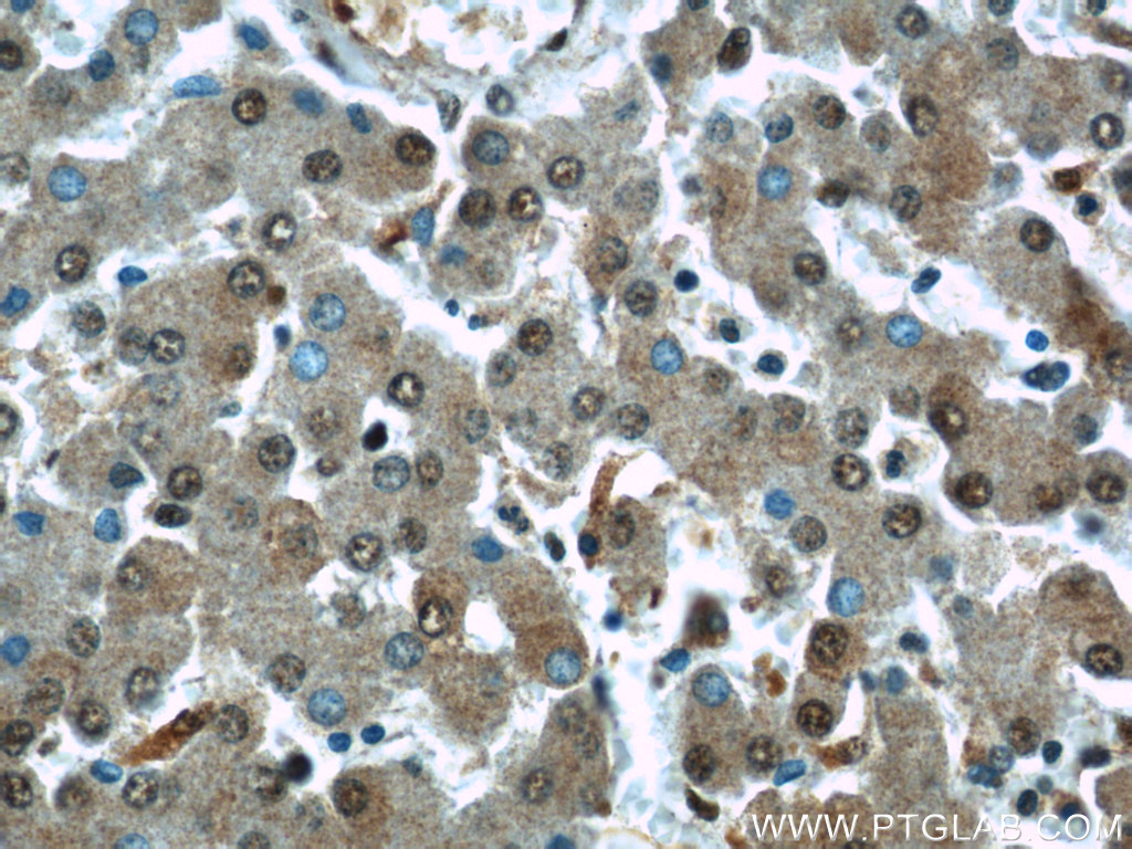 RAD23B antibody (12121-1-AP) | Proteintech