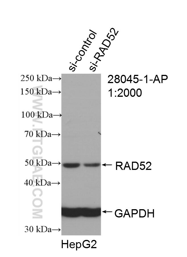 RAD52 antibody (28045-1-AP) | Proteintech | 武汉三鹰生物技术有限公司