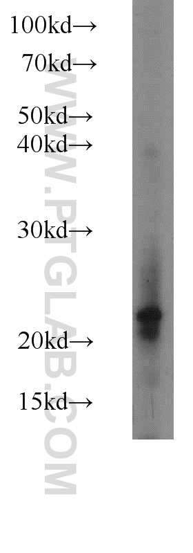 RBP4 Antibody 11774-1-AP | Proteintech