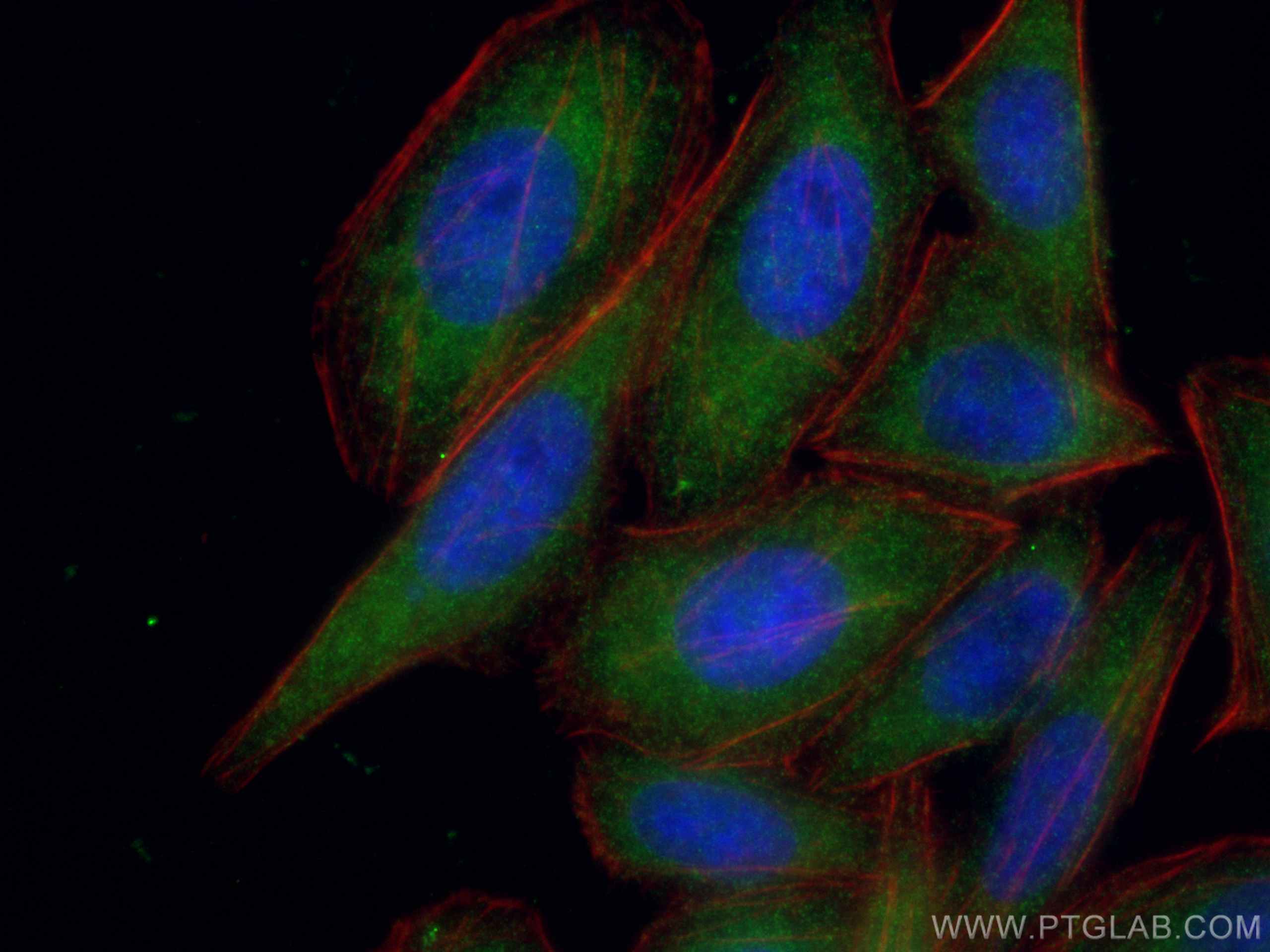 RBPMS antibody (15187-1-AP) | Proteintech | 武汉三鹰生物技术有限公司