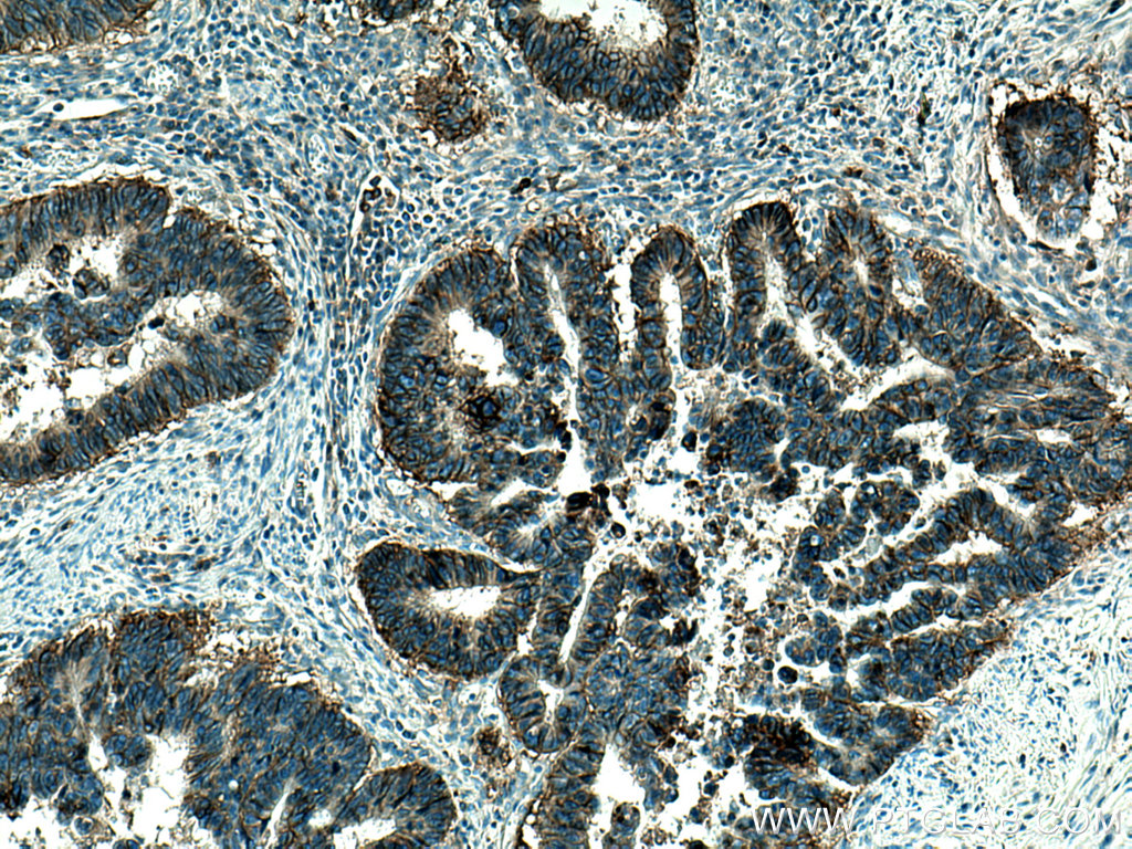 ASCT2 antibody (20350-1-AP) | Proteintech