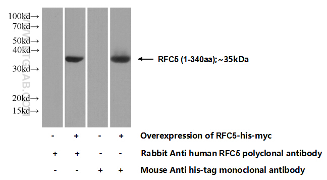 RFC5 Fusion Protein Ag26717 | Proteintech | 武汉三鹰生物技术有限公司