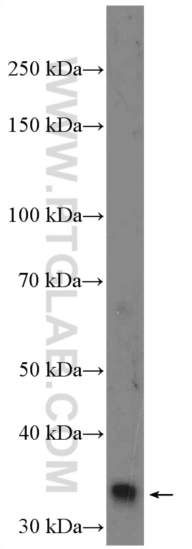 RFC5 antibody (10385-1-AP) | Proteintech | 武汉三鹰生物技术有限公司