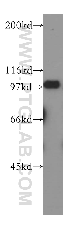 Talin-1 antibody (14168-1-AP) | Proteintech | 武汉三鹰生物技术有限公司