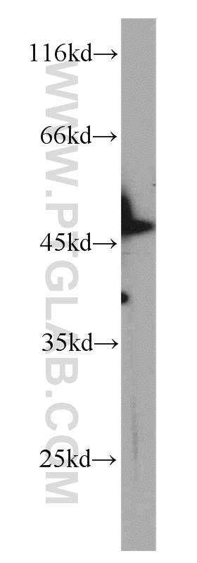 RPL3 antibody (11005-1-AP) | Proteintech