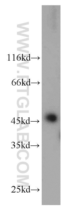 RPL3 antibody (11005-1-AP) | Proteintech