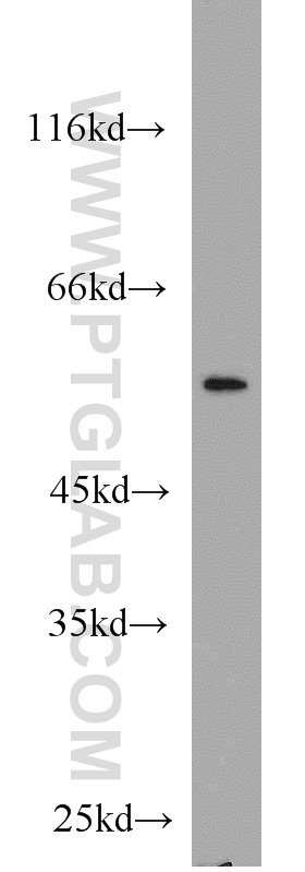 RUNX1 (N-terminal) antibody (19555-1-AP) | Proteintech | 武汉三鹰生物技术有限公司