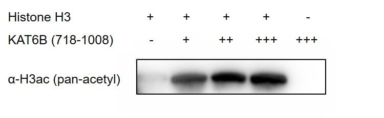 Recombinant KAT6B / MORF (718-1008) protein | Proteintech | 武汉三鹰生物技术有限公司