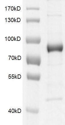 Recombinant KAT7 protein | Proteintech | 武汉三鹰生物技术有限公司