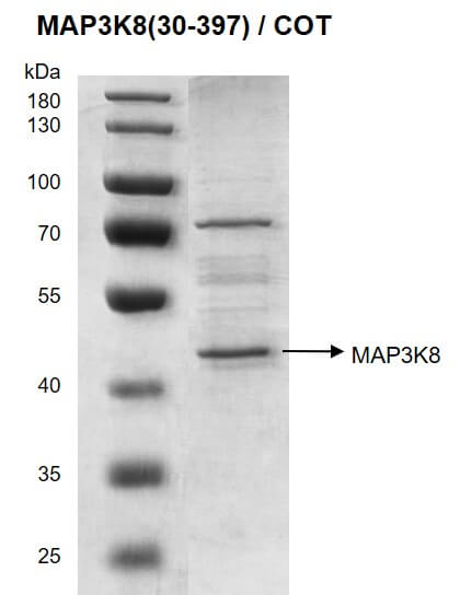 Recombinant MAP3K8 (30-397) / COT protein | Proteintech | 武汉三鹰生物技术有限公司