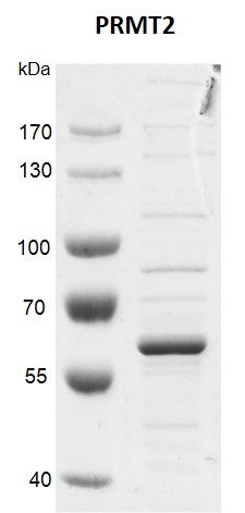 Recombinant PRMT2 protein | Proteintech | 武汉三鹰生物技术有限公司