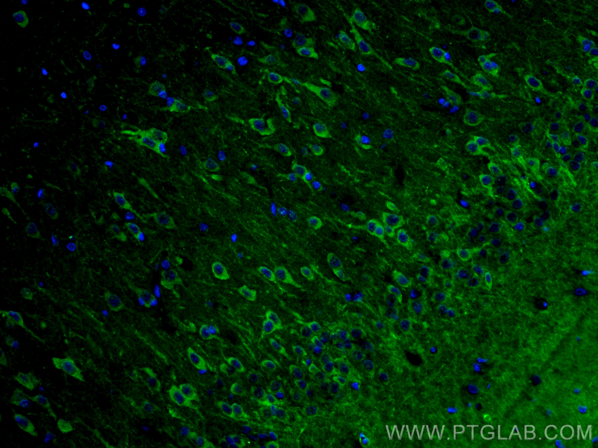 S100A10 antibody (11250-1-AP) | Proteintech | 武汉三鹰生物技术有限公司