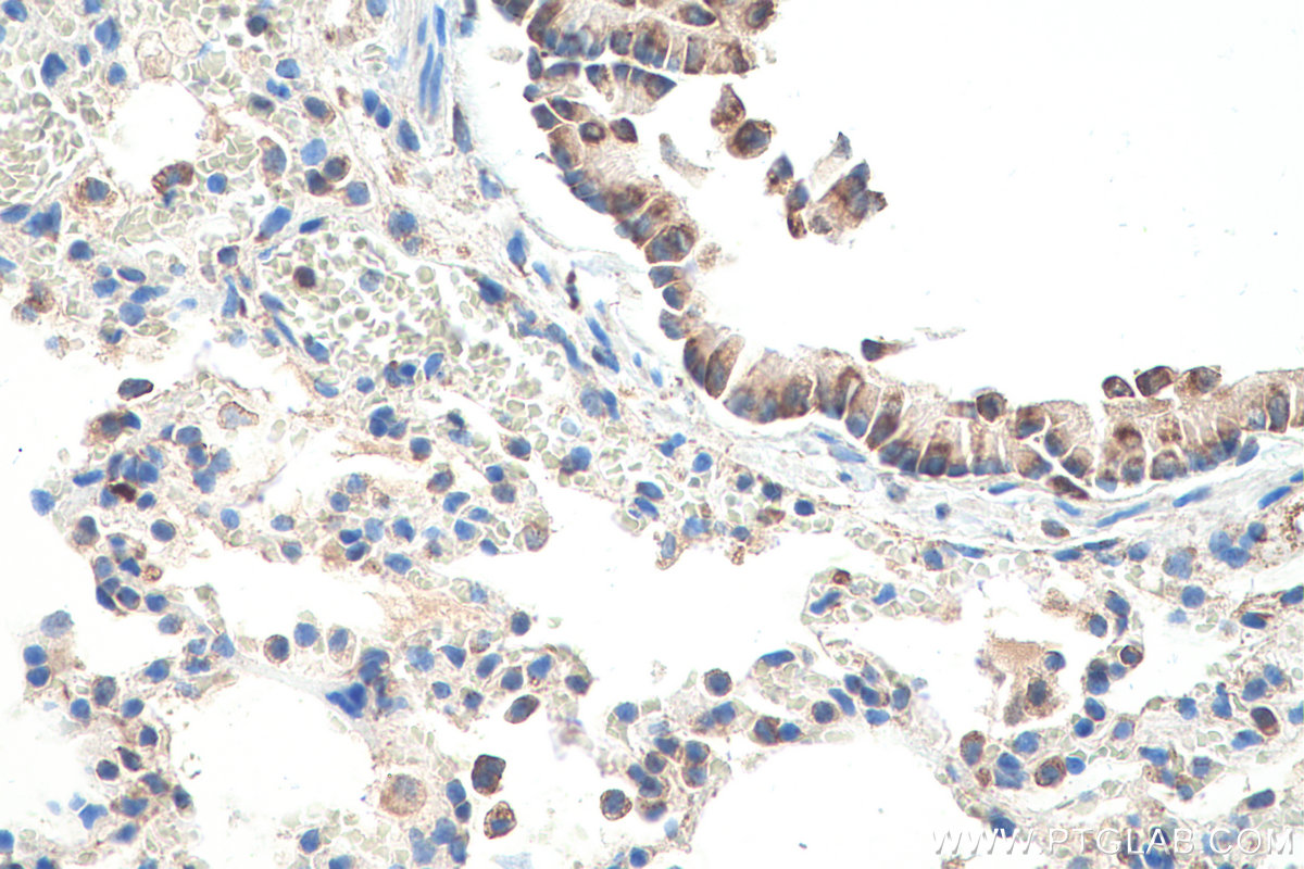 S100A10 antibody (66227-1-Ig) | Proteintech | 武汉三鹰生物技术有限公司