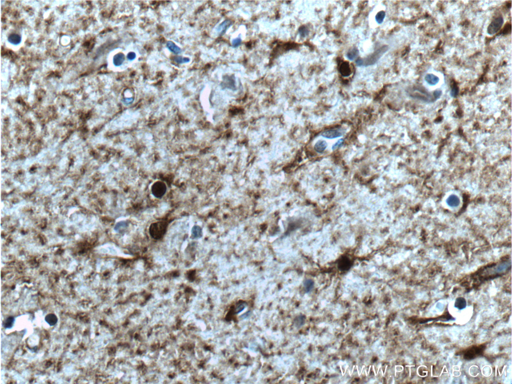 S100 Beta Antibody 66616-1-Ig | Proteintech