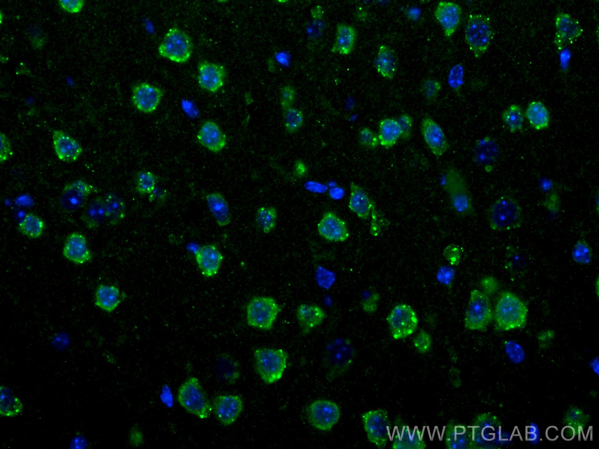 S1PR2 antibody (21180-1-AP) | Proteintech | 武汉三鹰生物技术有限公司