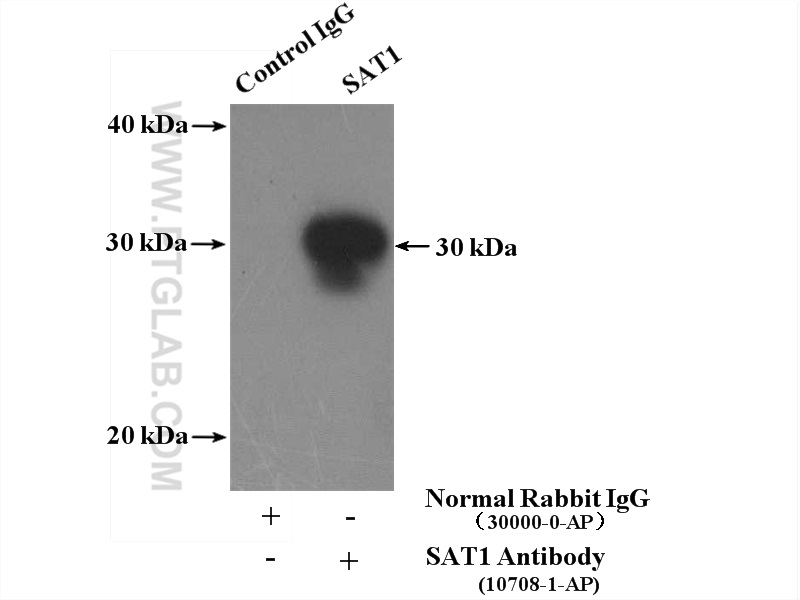 SAT1 antibody (10708-1-AP) | Proteintech | 武汉三鹰生物技术有限公司