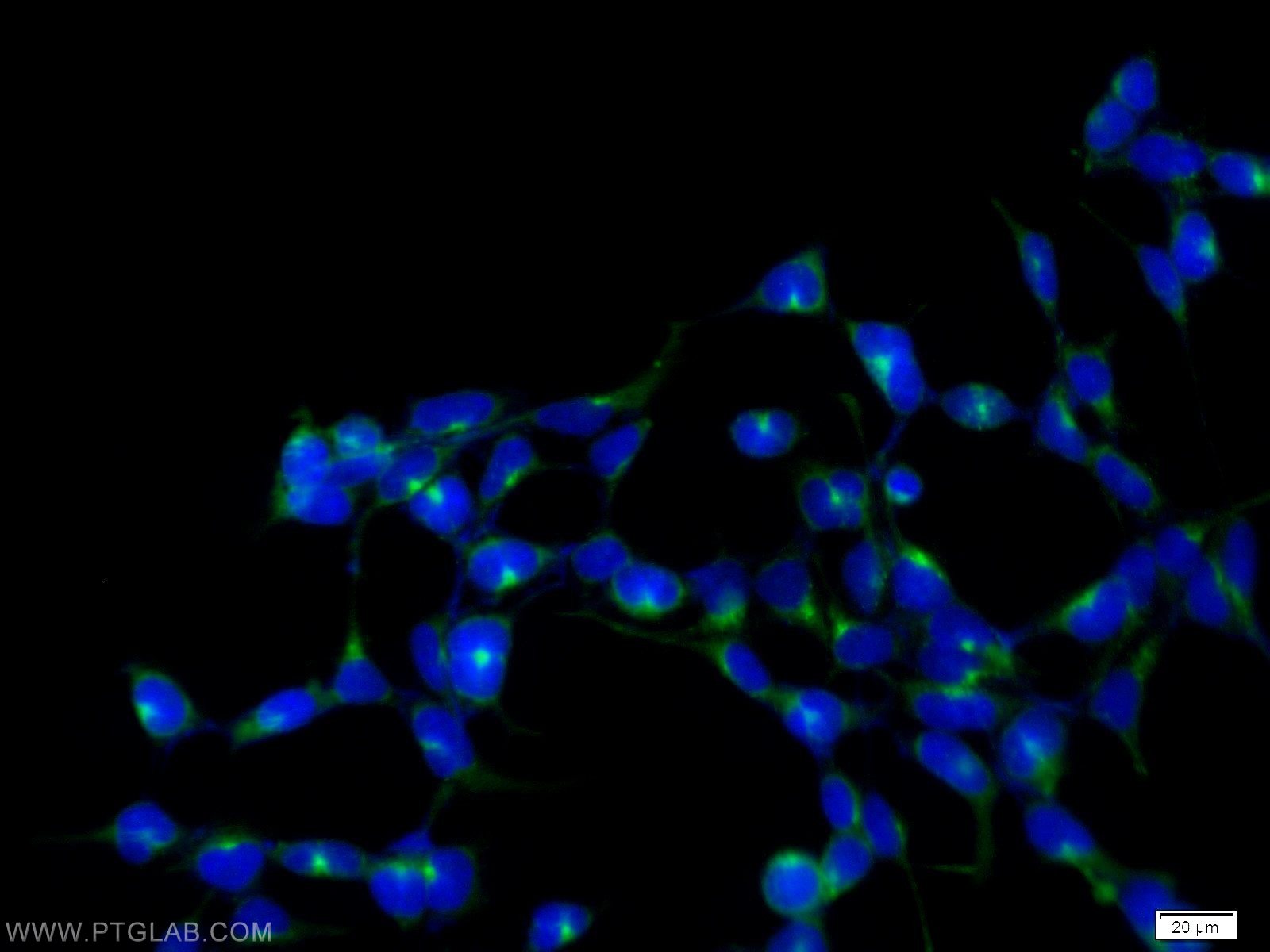 SCAMP2 antibody (15119-1-AP) | Proteintech | 武汉三鹰生物技术有限公司