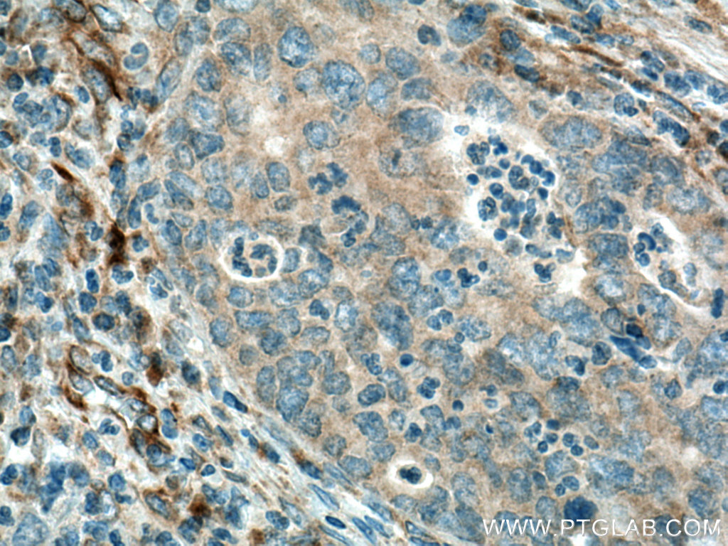 SCAP antibody (12266-1-AP) | Proteintech | 武汉三鹰生物技术有限公司