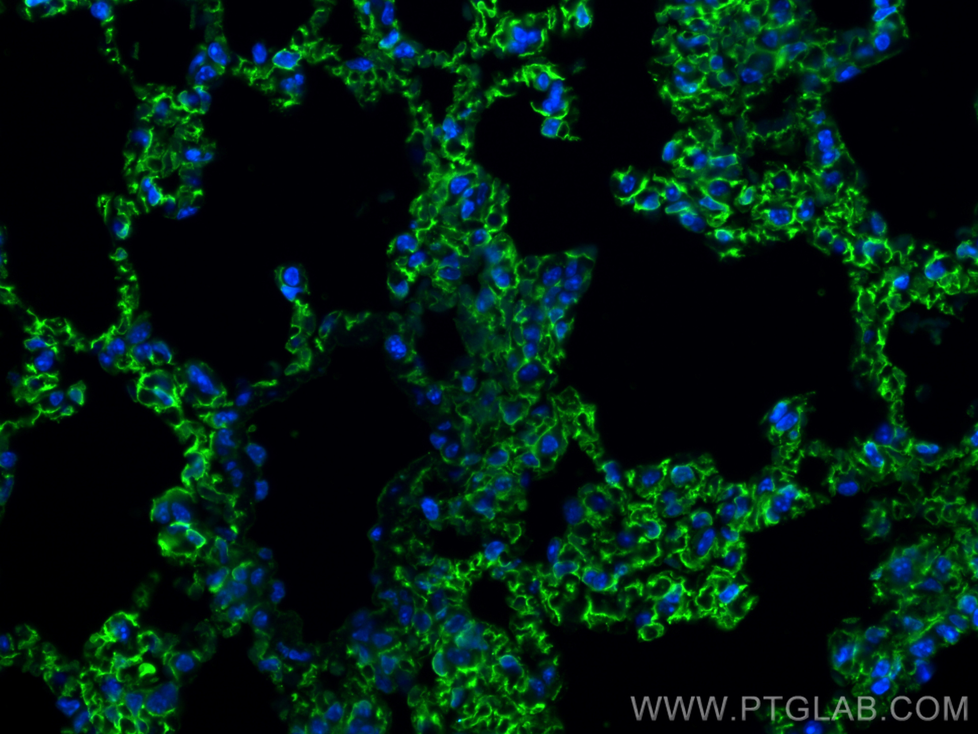 Uteroglobin/CC10 antibody (10490-1-AP) | Proteintech | 武汉三鹰生物技术有限公司