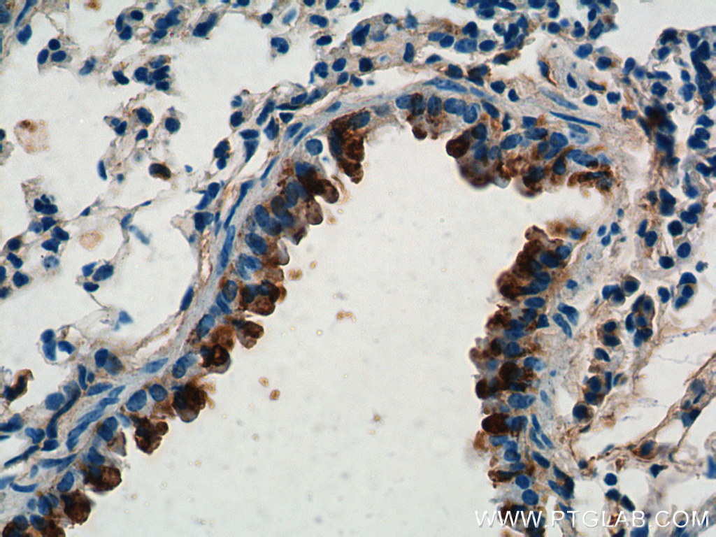 Uteroglobin/CC10 antibody (10490-1-AP) | Proteintech | 武汉三鹰生物技术有限公司