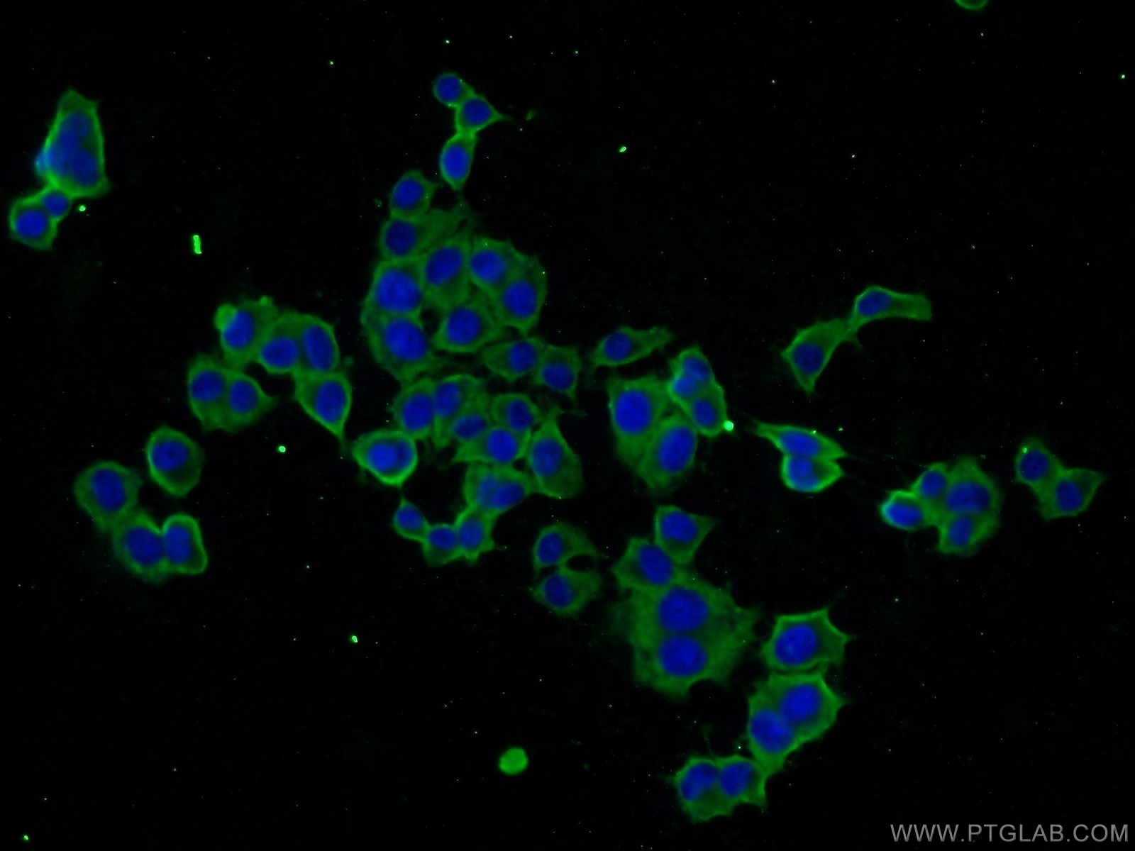 SCN9A/Nav1.7-Specific antibody (20257-1-AP) | Proteintech