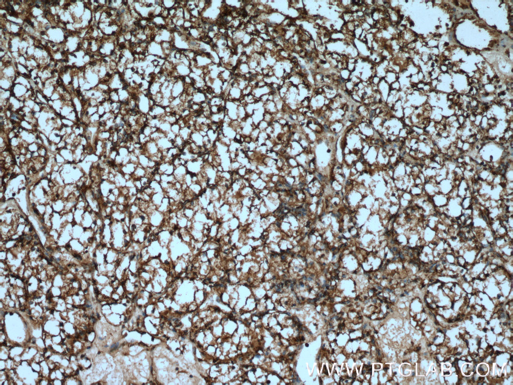 SDHB Antibody 10620-1-AP | Proteintech