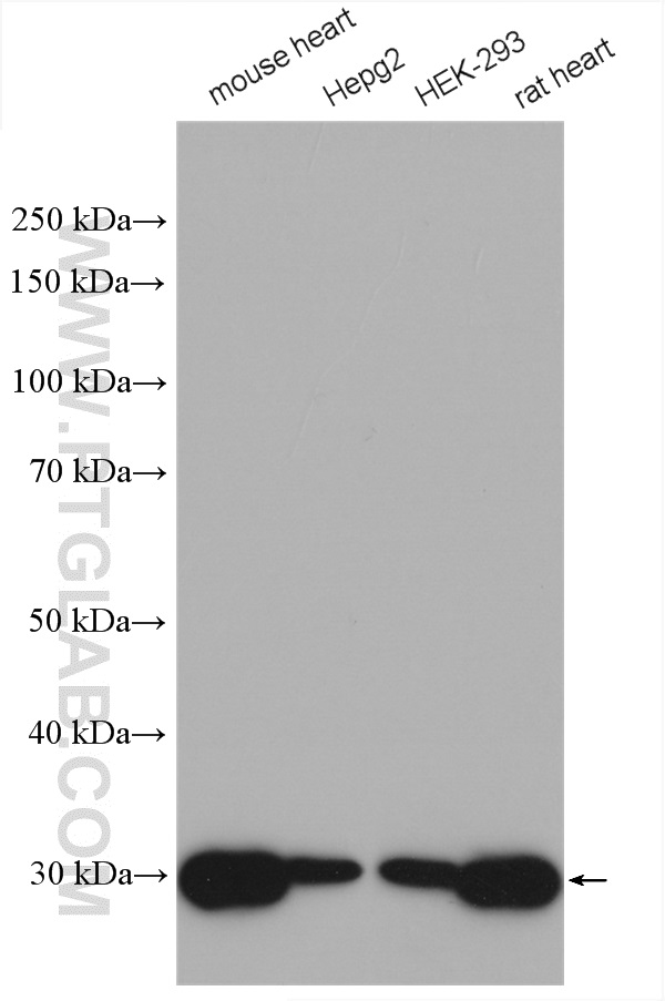 SDHB antibody (10620-1-AP) | Proteintech | 武汉三鹰生物技术有限公司