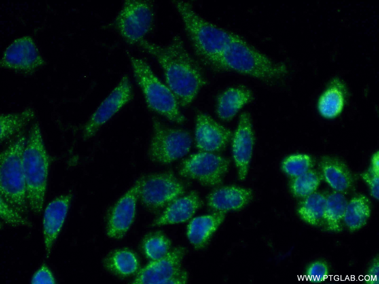 SEC31A antibody (17913-1-AP) | Proteintech | 武汉三鹰生物技术有限公司