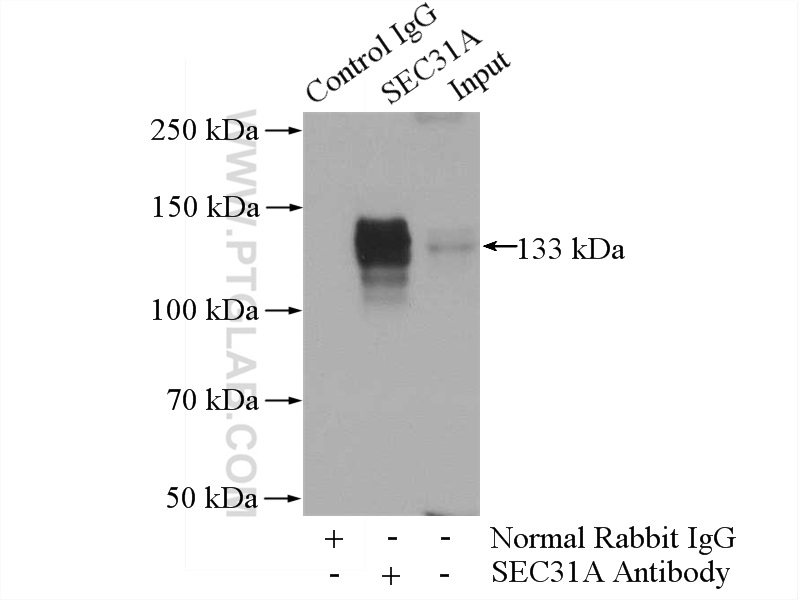 SEC31A antibody (17913-1-AP) | Proteintech | 武汉三鹰生物技术有限公司