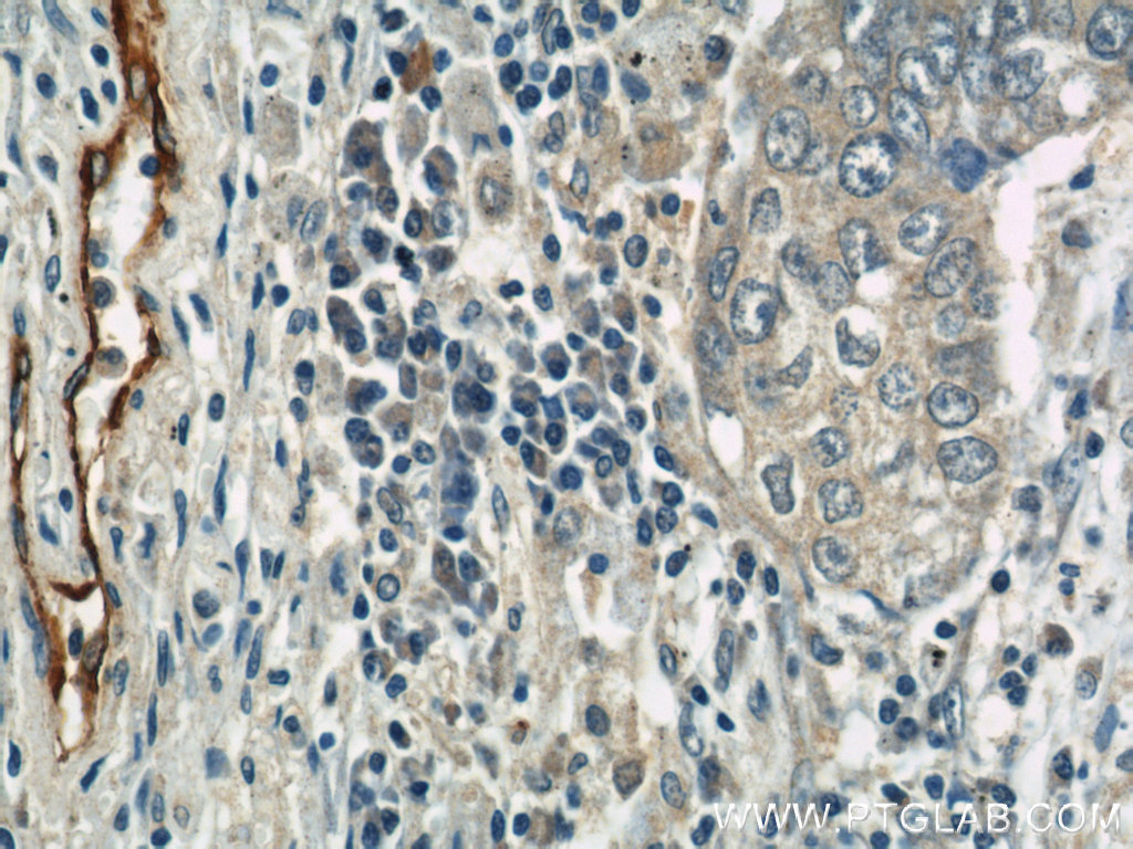 VCAM-1 antibody (11444-1-AP) | Proteintech