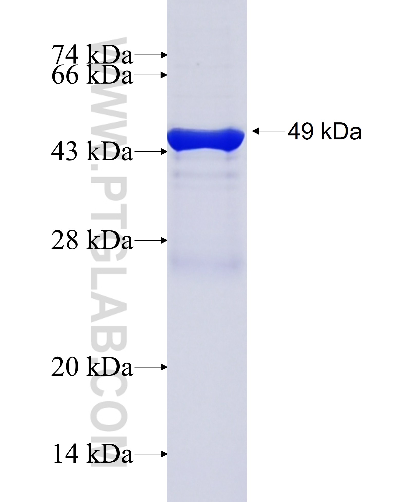 SERPINE2 Fusion Protein Ag32555 | Proteintech | 武汉三鹰生物技术有限公司