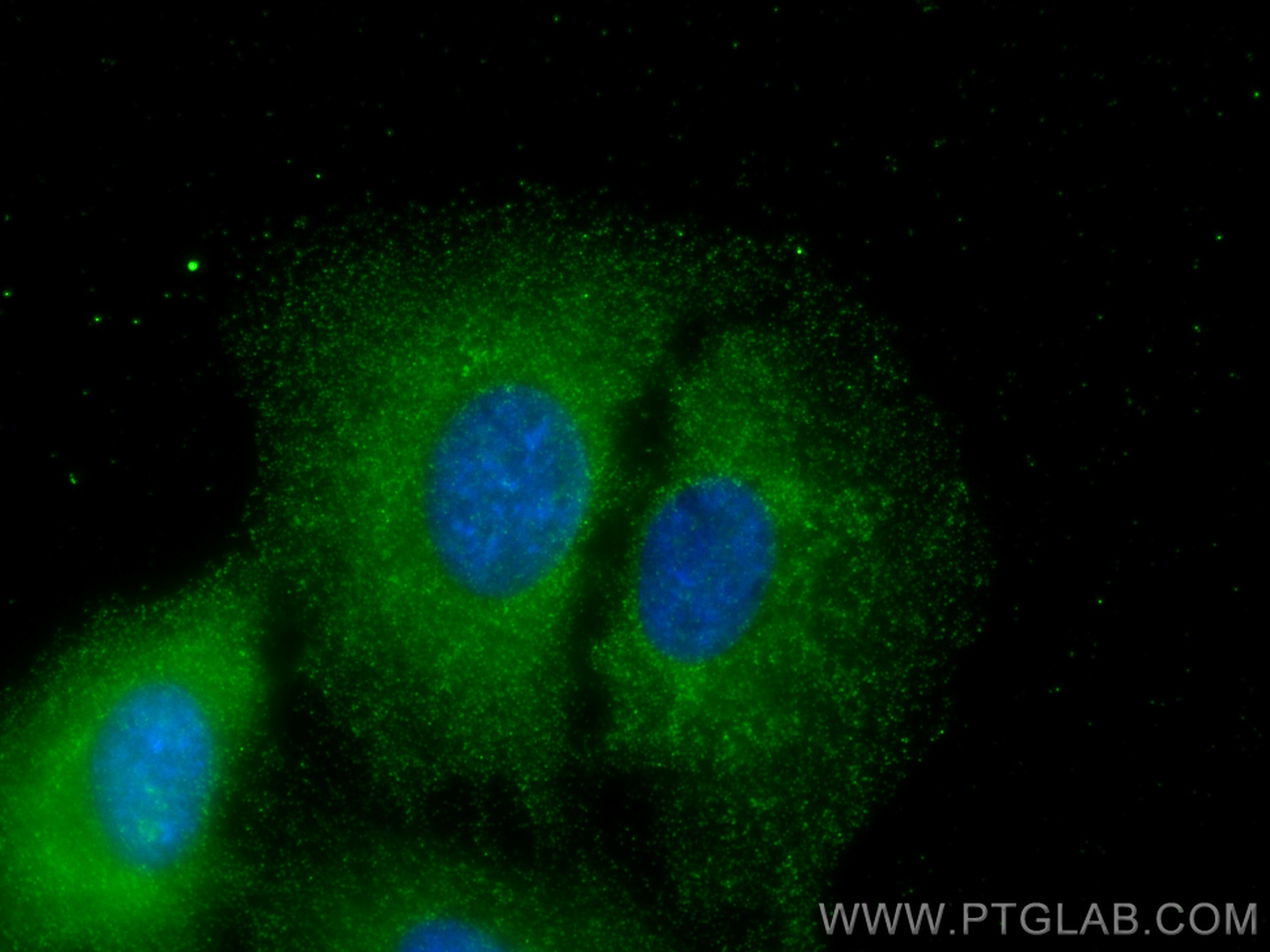 SFTPC antibody (10774-1-AP) | Proteintech | 武汉三鹰生物技术有限公司