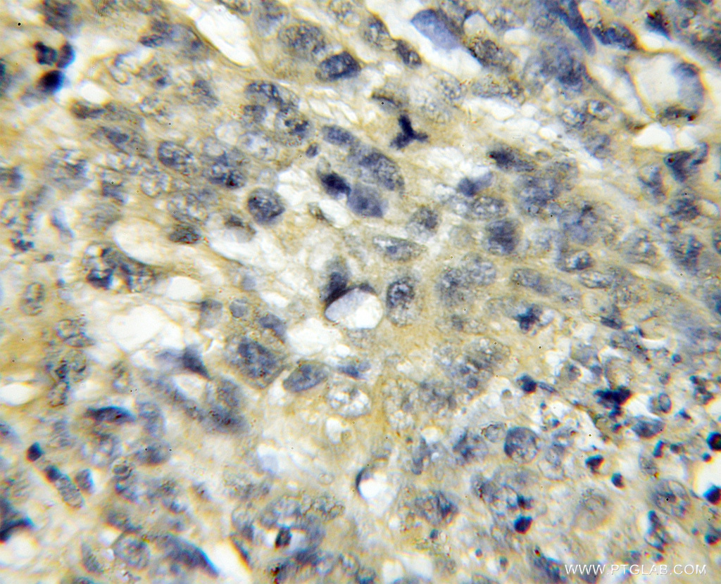 Uteroglobin/CC10 antibody (10490-1-AP) | Proteintech