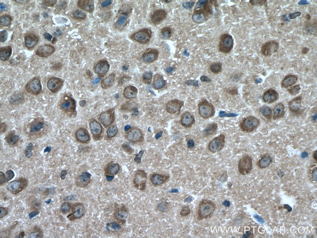 VGLUT1 antibody (55491-1-AP) | Proteintech | 武汉三鹰生物技术有限公司