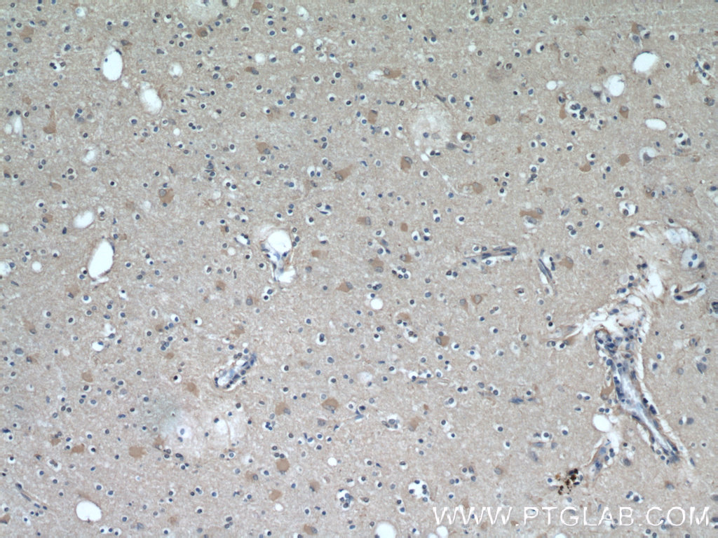 VGLUT1 antibody (55491-1-AP) | Proteintech | 武汉三鹰生物技术有限公司