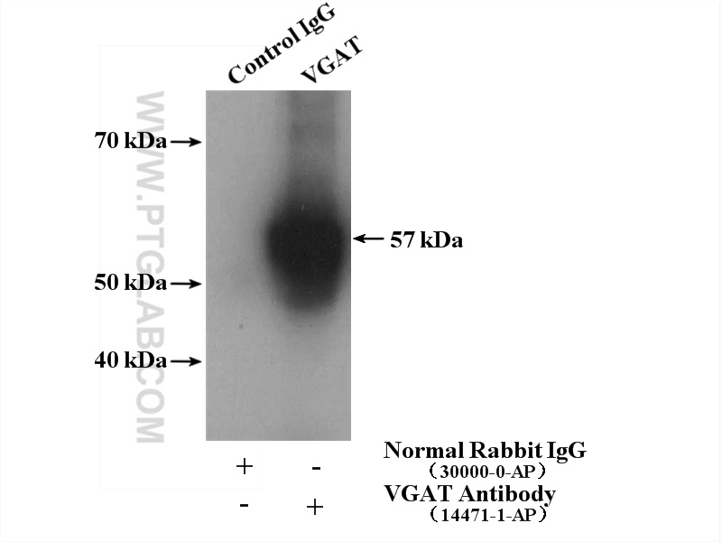 VGAT antibody (14471-1-AP) | Proteintech | 武汉三鹰生物技术有限公司