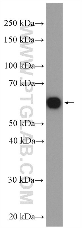VGAT Antibody 14471-1-AP | Proteintech
