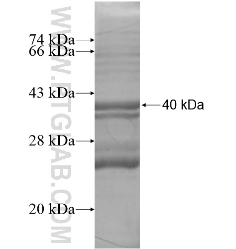 SLC39A11 Fusion Protein Ag14541 | Proteintech | 武汉三鹰生物技术有限公司